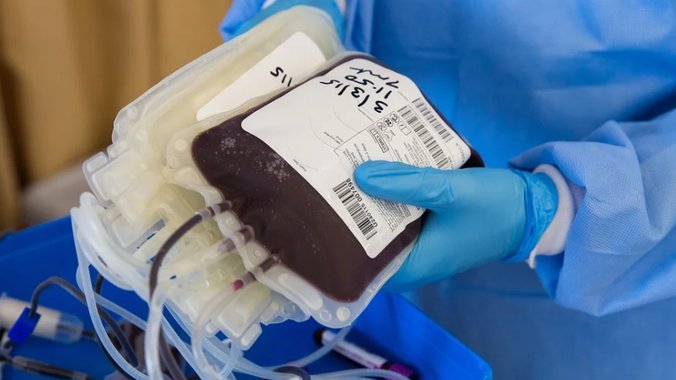 KAKO SE TUMAČI KRVNA SLIKA: Evo šta sve znače one skraćenice i njihove vrednosti! | pink.rs