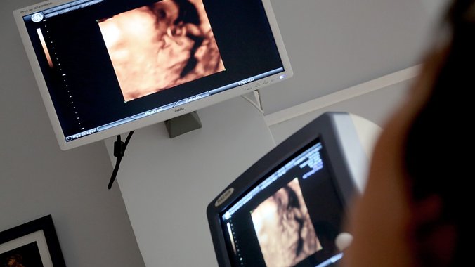 Četiri iznenađujuće činjenice o drugom porođaju koje niste znali | pink.rs