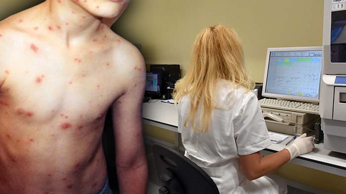 POZNATI VIRUSOLOG OTKRIO ZBOG ČEGA SU MORBILE OPASNE I DA LI VIRUS ...