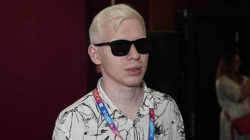 PROSLAVIO SE KAO ALBINO, A OVO JE NJEGOV PUT DO ZVEZDA! Stjepan živi sa ...