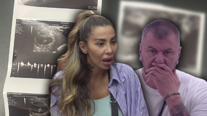 POGLEDAJTE ANELIN SNIMAK S ULTRAZVUKA! Ahmićeva danas obavila pregled, a ovo je njena i ...