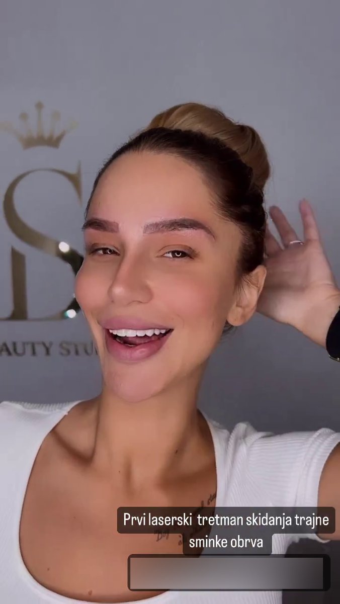 POBEDNICA ZADRUGE SE PODVRGLA NOVOJ ESTETSKOJ KOREKCIJI! Aleksandra Nikolić nakon raskida ...